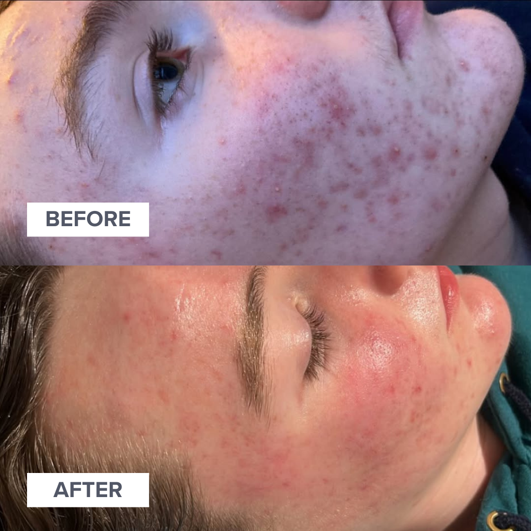 The Baseline Glow Facial Atlanta | Custom Anti-Oxidant Hydrating ...